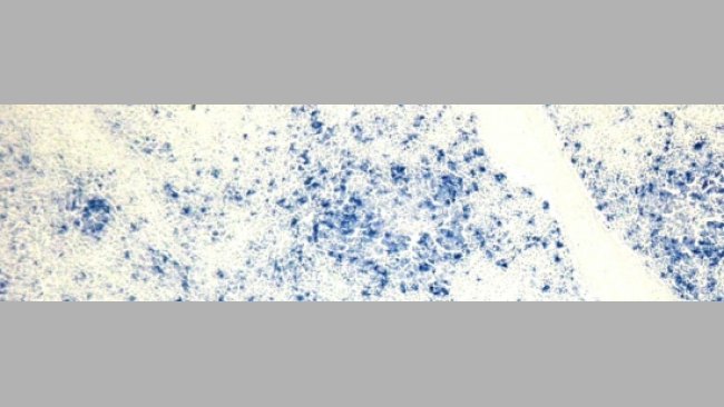 PCV2 y su asociación a otras condiciones clínico-patológicas ...